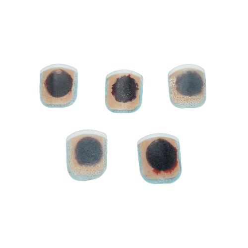 Replacement Nails - Subungal Hematoma Trephination trainer – Medimodels