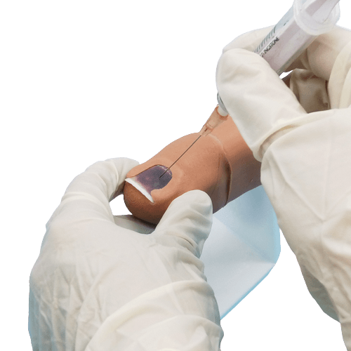 Replacement Nails - Subungal Hematoma Trephination trainer – Medimodels
